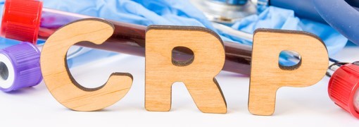 Doctors - בדיקת חלבון CRP בדם (C-Reactive Protein), בדיקות דם - כימיה