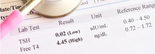 Doctors - בדיקת Free T4 - Thyroxine, בדיקות מעבדה - אנדוקרינולוגיה